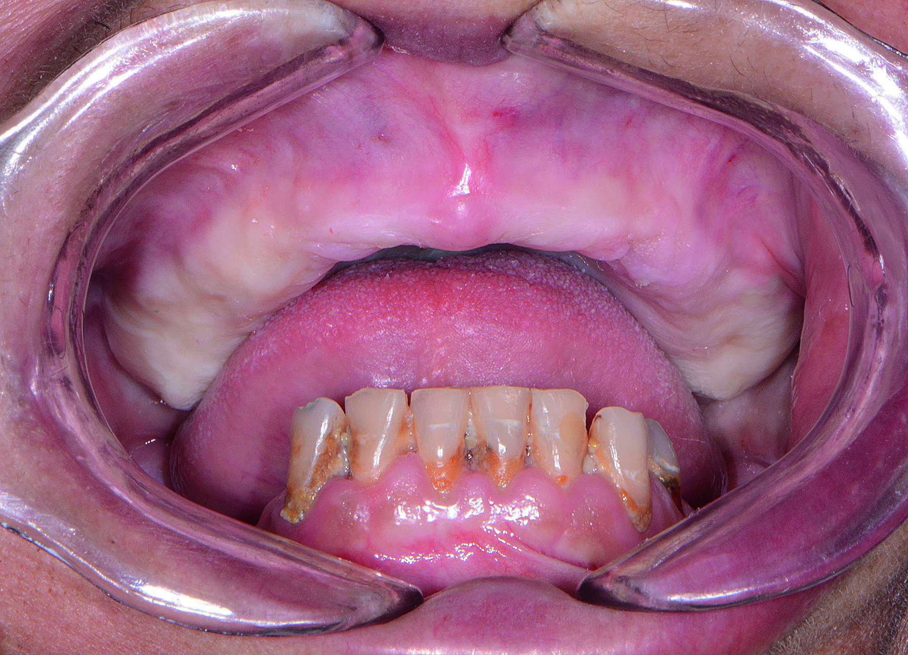 Dental News - Incorporating CAD/CAM solutions for full-mouth dental ...